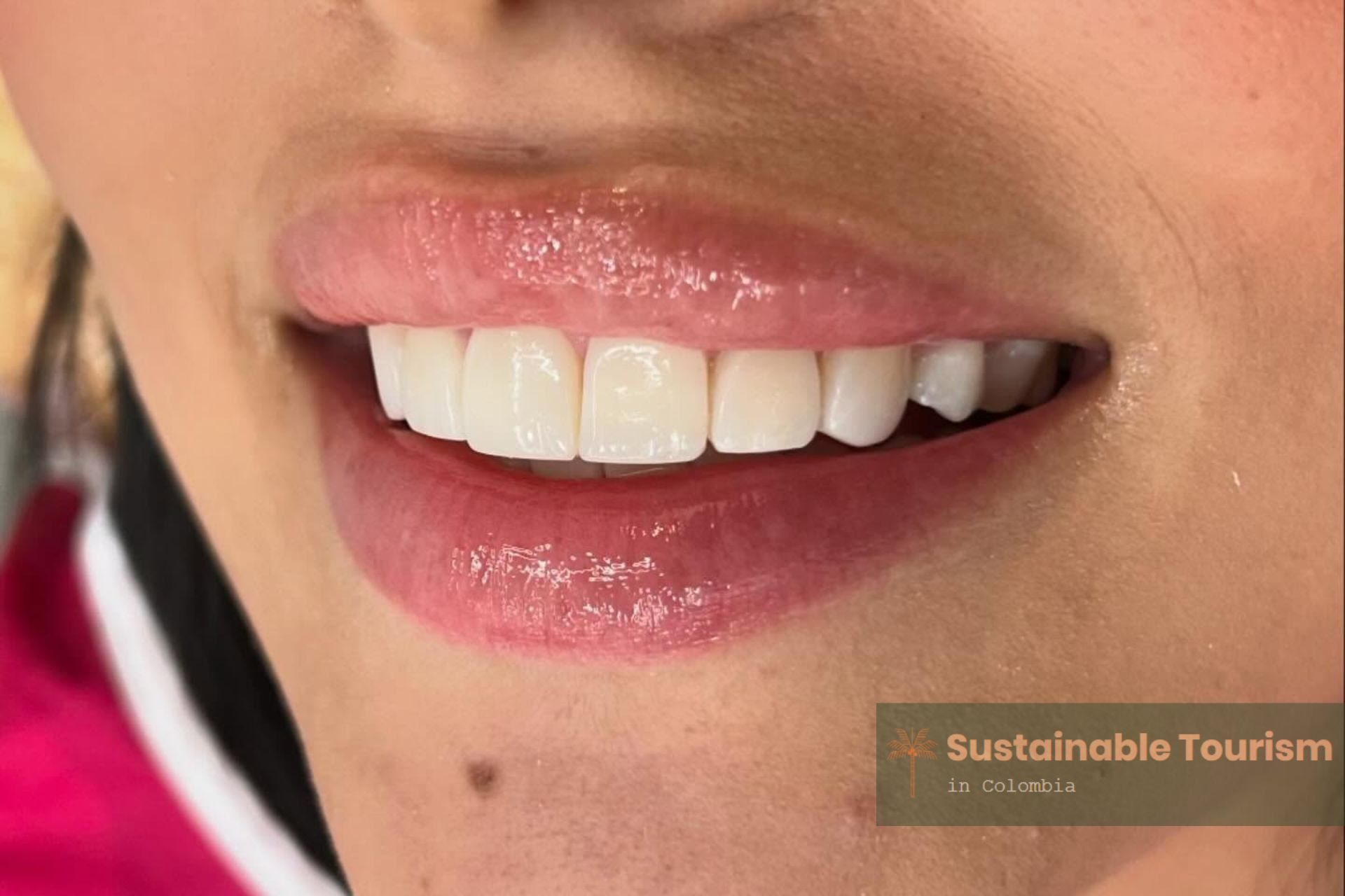 iBocca Dental Clinic: Excellence in Dental Tourism in Colombia